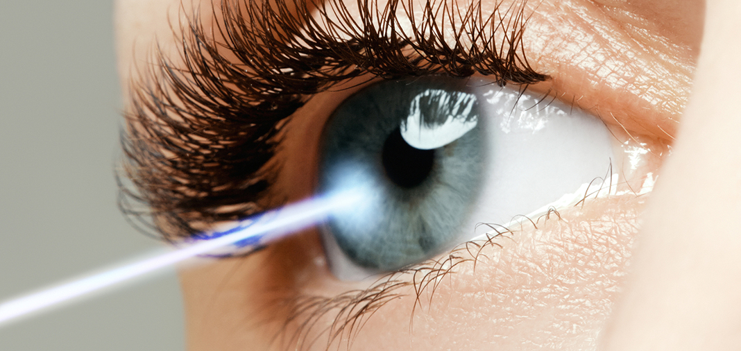 Las 6 preguntas más frecuentes sobre el procedimiento LASIK - Artículos